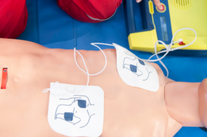 Cadena de Supervivencia: RCP y Desfibrilación Temprana